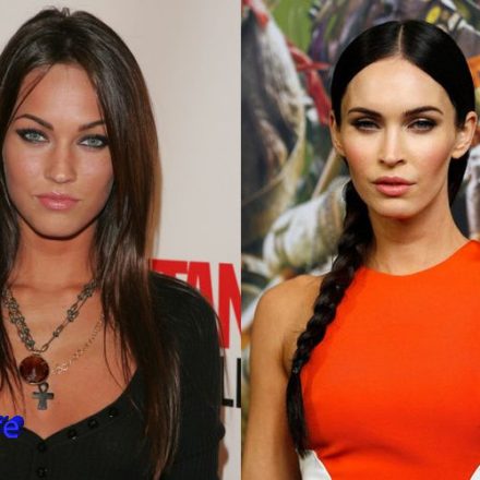 Megan Fox Plastic Surgery Before and After - Plastic Surgery Mistakes