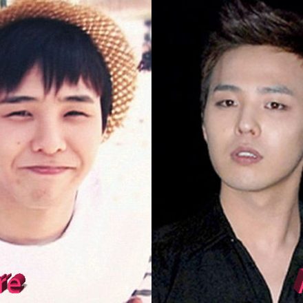 G Dragon Plastic Surgery: Big Changes For Kpop Star