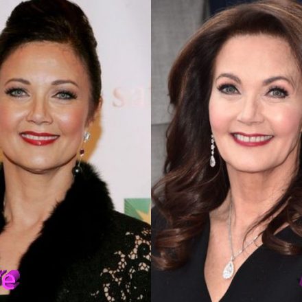 Lynda Carter Before and After Cosmetic Surgery - Plastic Surgery Mistakes